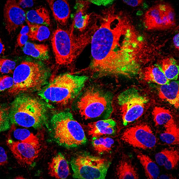 Surface Expressed Nucleocapsid Protein On Infected Cells Ucr News Uc Riverside 
