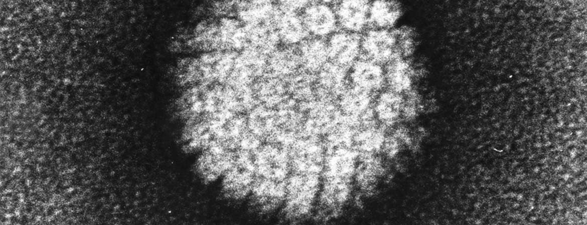 Study links individual HPV types to HIV infection | UCR News | UC Riverside